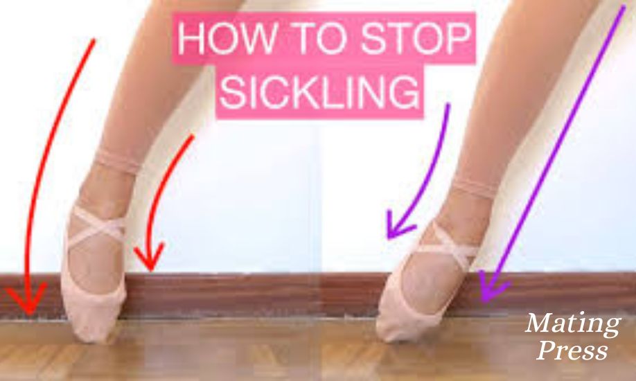 Sickled Feet: Transform Your Dance Technique and Prevent Injuries